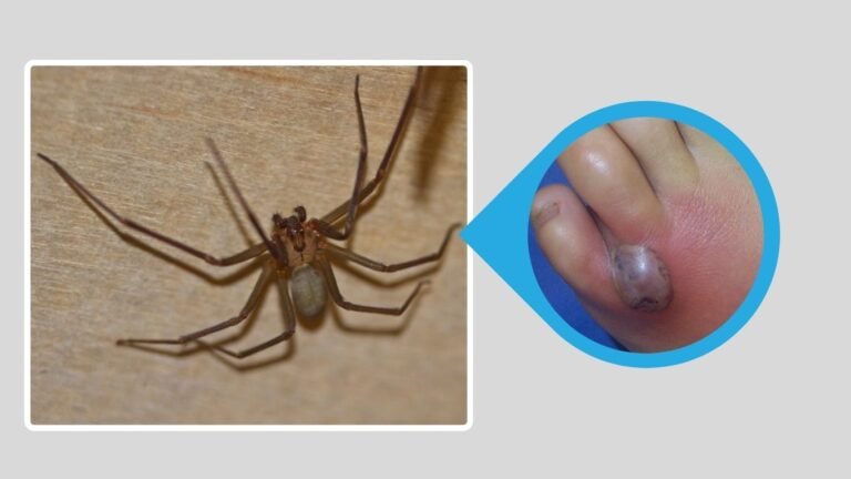 15 Types of Recluse Spiders: Identification, Habits, and Bite Symptoms