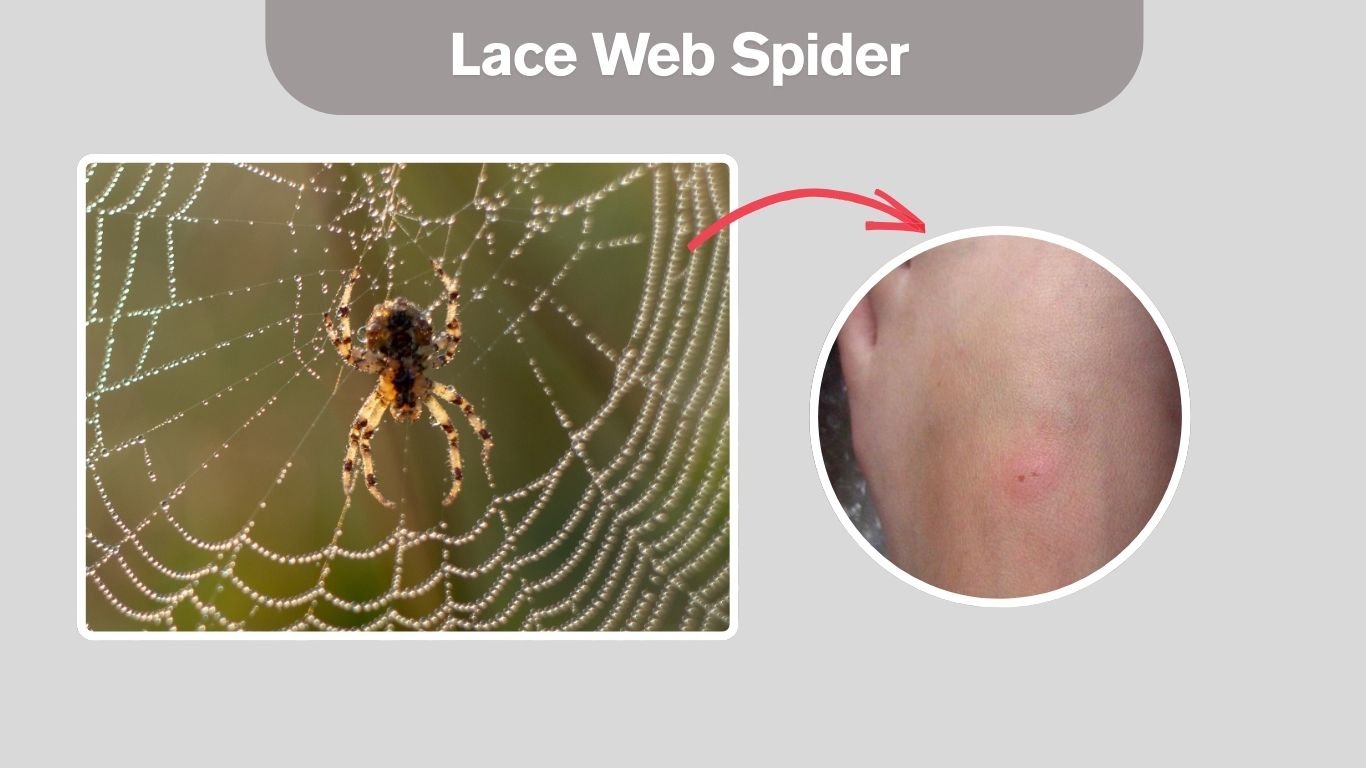 14 Types of Spider In UK That Bites: Identifying Species By Images